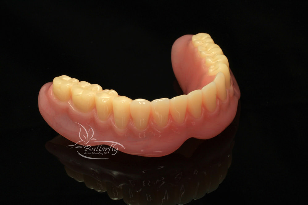 BDLab - Dental Laboratory - Dental Implants, Prosthesis - Acrylic Dentures