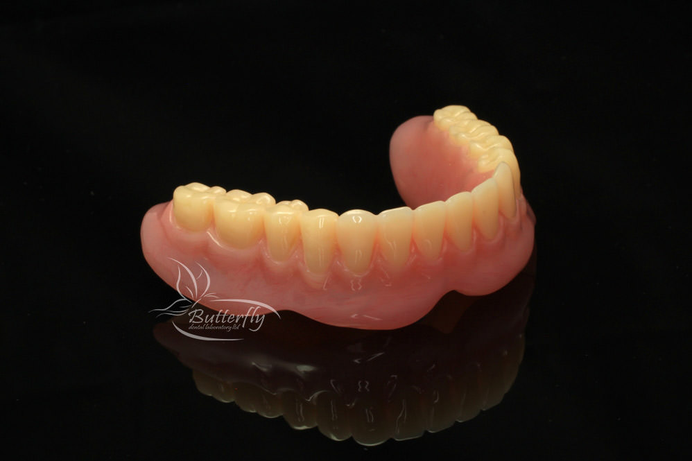 BDLab - Dental Laboratory - Dental Implants, Prosthesis - Acrylic Dentures
